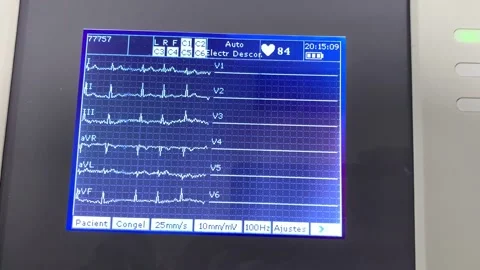 4k Electrocardiogram, ECG | Stock Video | Pond5