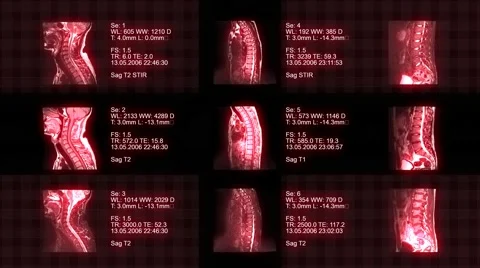 4k red Medical Background. Video showing... | Stock Video | Pond5