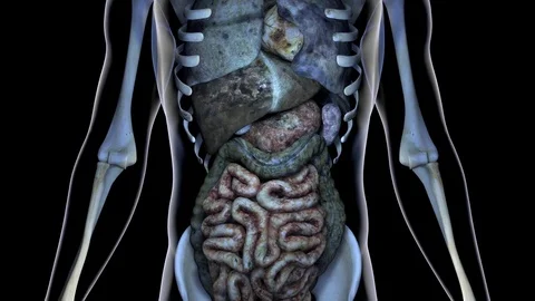 4K Sick Internal Organs in a Transparent... | Stock Video | Pond5