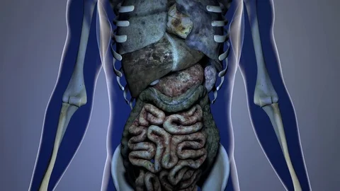 4K Sick Internal Organs in a Transparent... | Stock Video | Pond5
