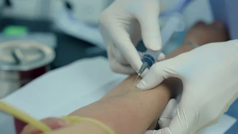 4K, Slow, Close-up patient's arm being b... | Stock Video | Pond5