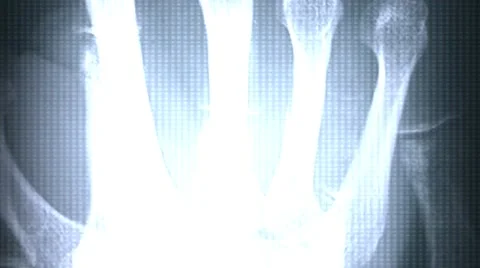 Radiology Stock Video Footage | Royalty Free Radiology Videos | Pond5