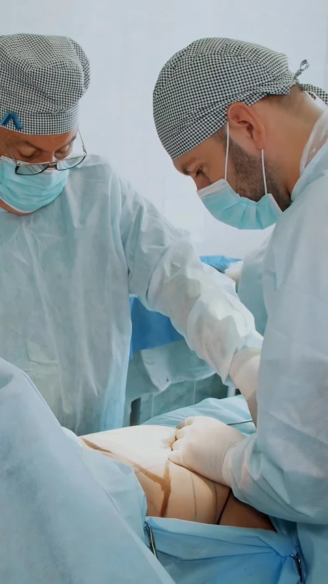 Liposuction Surgeons Stock Videos – Royalty-Free HD & 4K Videos