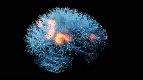 Abnormal brain activity, animation | Stock Video | Pond5