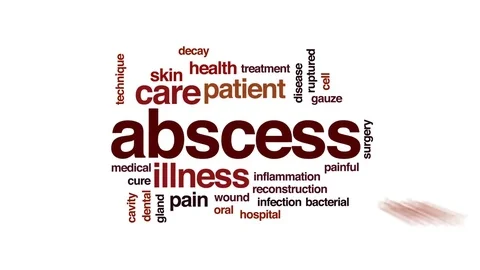 Abscess animated word cloud, text design... | Stock Video | Pond5
