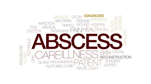 Abscess animated word cloud, text design... | Stock Video | Pond5