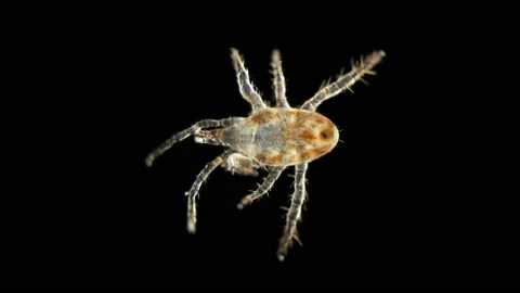 Acari, a saprophage mite, under a micros... | Stock Video | Pond5