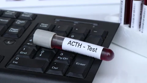 ACTH test, blood sample to analyze in th... | Stock Video | Pond5
