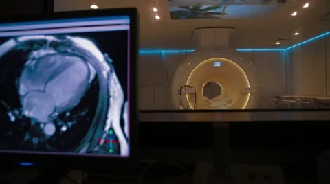 Actual Scans Of The Human Heart | Stock Video | Pond5