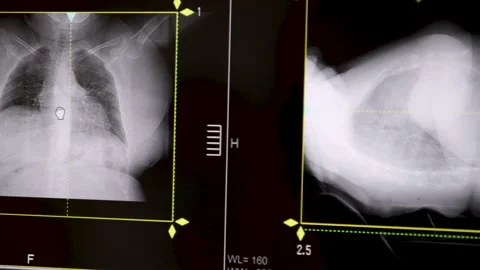advanced x-ray chest full body in clinic... | Stock Video | Pond5