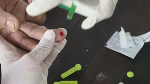 Scar Blood Stock Footage ~ Royalty Free Stock Videos | Pond5