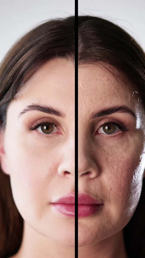 Wrinkles Before After Stock Videos – Royalty-Free HD & 4K Videos | Pond5