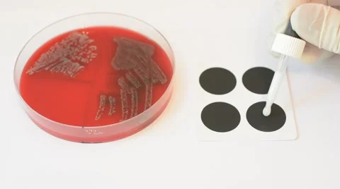 Staphylococcus Aureus Stock Videos – Royalty-Free HD & 4K Videos | Pond5