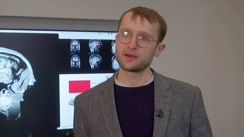AI can spot 'invisible' brain abnormalit... | Stock Video | Pond5