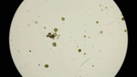 Eudorina Algae Eudorina