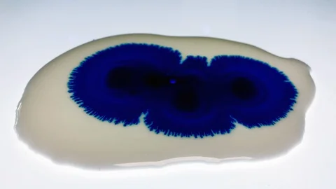 Bleeding Vein Stock Video Footage | Royalty Free Bleeding Vein Videos ...