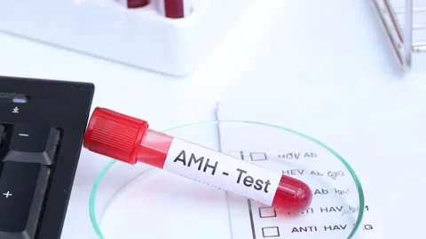 AMH test to look for abnormalities from ... | Stock Video | Pond5