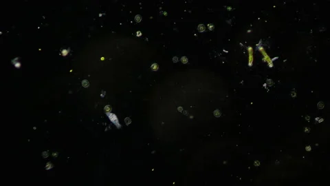 Amoeba and many other microorganisms in ... | Stock Video | Pond5