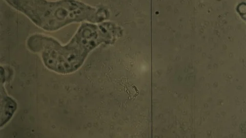 Amoeba Microscopic Microscope Cell Micro... | Stock Video | Pond5