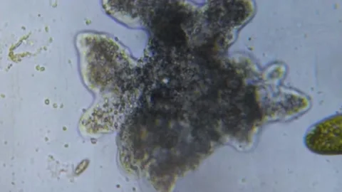 Pseudopodia Stock Video Footage | Royalty Free Pseudopodia Videos | Pond5