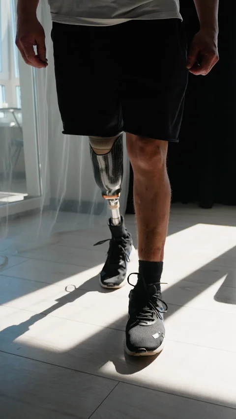 Amputee Man Learning to Walk with Prosth... | Stock Video | Pond5
