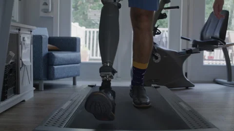 Amputee slow motion walking on tread mil... | Stock Video | Pond5