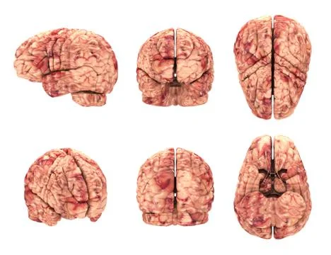 Actual Human Brain Labelled