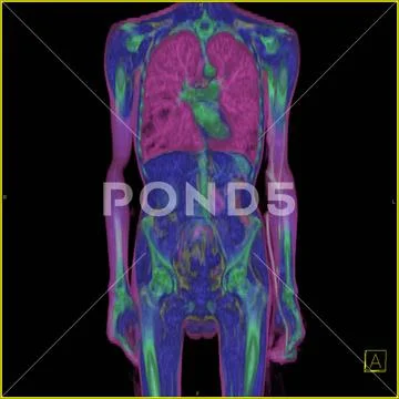 Anatomy Entire body, frontal view. 3D CT scan. The icon at the bottom ...