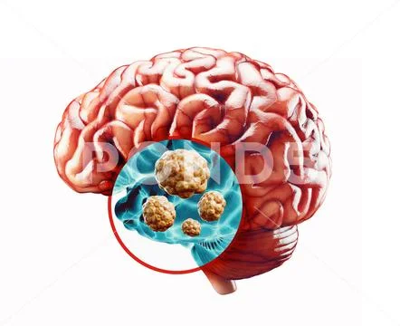 Anatomy of realistic 3d illustration of human internal organ - brain ...