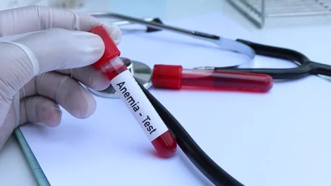 anemia test to look for abnormalities fr... | Stock Video | Pond5