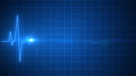 Ekg Monitor Animated Heart Stock Video Footage | Royalty Free Ekg ...