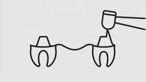 Animated dental bridge linear icon | Stock Video | Pond5