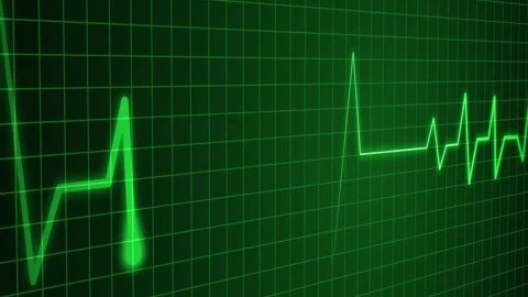 Animated ECG Heartbeat Line Loop for Med... | Stock Video | Pond5