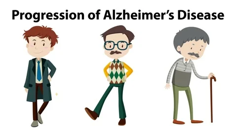 Animated Guide to the Stages of Alzheime... | Stock Video | Pond5