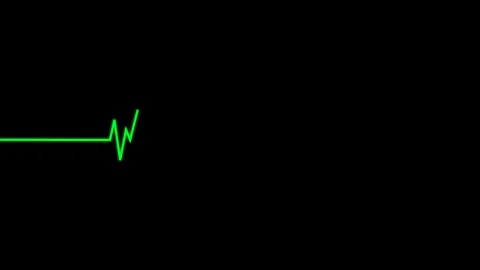 Ekg Monitor Animated Heart Stock Video Footage | Royalty Free Ekg ...