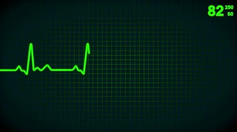 Lifeline Stock Footage ~ Royalty Free Stock Videos | Pond5