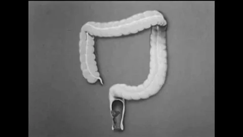 An animated sequence shows the mortality... | Stock Video | Pond5