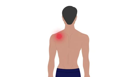 Animated video of a man with shoulder pa... | Stock Video | Pond5