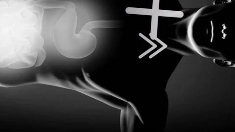 Animation of falling shapes over human b... | Stock Video | Pond5