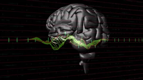 Animation of graphs over rotating brain ... | Stock Video | Pond5