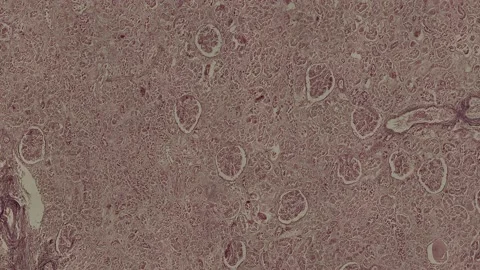 Animation of human kidney cells under a ... | Stock Video | Pond5