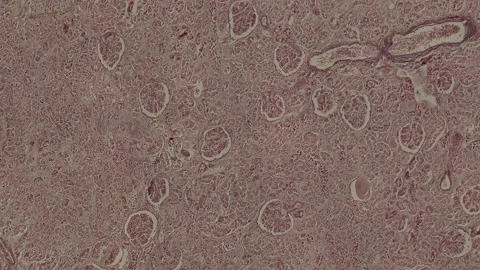 Animation of human kidney cells under a ... | Stock Video | Pond5