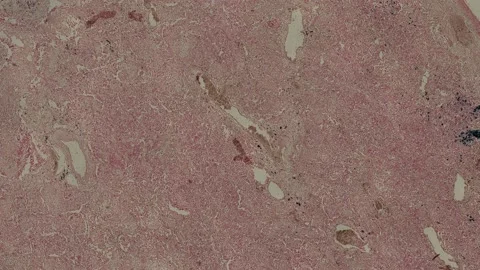 Animation of human kidney cells under a ... | Stock Video | Pond5