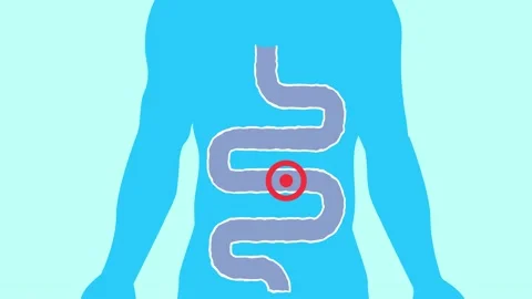 Animation of Intestinal Microbiome - Col... | Stock Video | Pond5