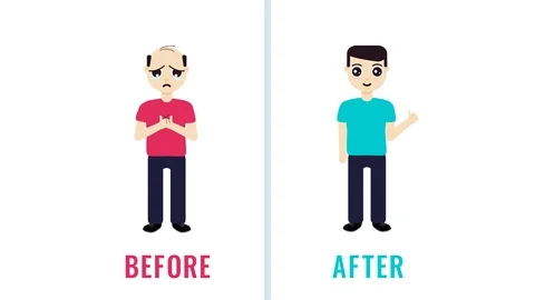 Hair Loss Before After Stock Video Footage | Royalty Free Hair Loss ...