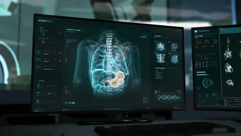 Animation Of Medical Analysis Of Patient... | Stock Video | Pond5
