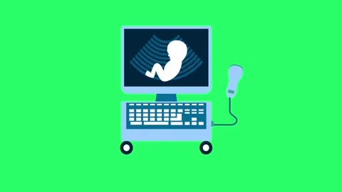 Animation monitor physical examination o... | Stock Video | Pond5