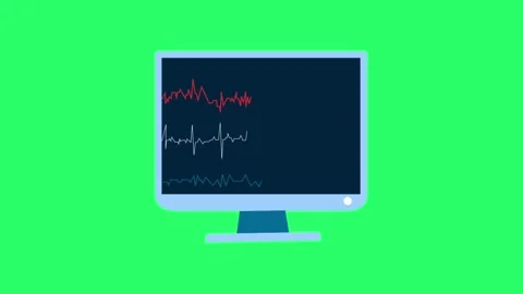 Animation monitor physical examination o... | Stock Video | Pond5