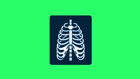 Animation monitor physical examination x... | Stock Video | Pond5