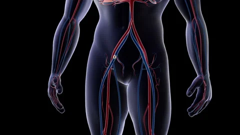 Animation of pulmonary embolism, a block... | Stock Video | Pond5